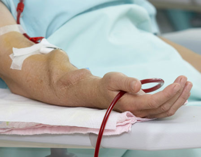 IN SITU TISSUE ENGINEERED VASCULAR ACCESSES FOR HAEMODIALYSIS | LifeTec ...