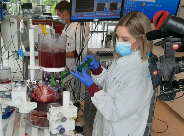 ULTRASTRUCTURAL CHARACTERISTICS OF MYOCARDIAL REPERFUSION INJURY AND ...