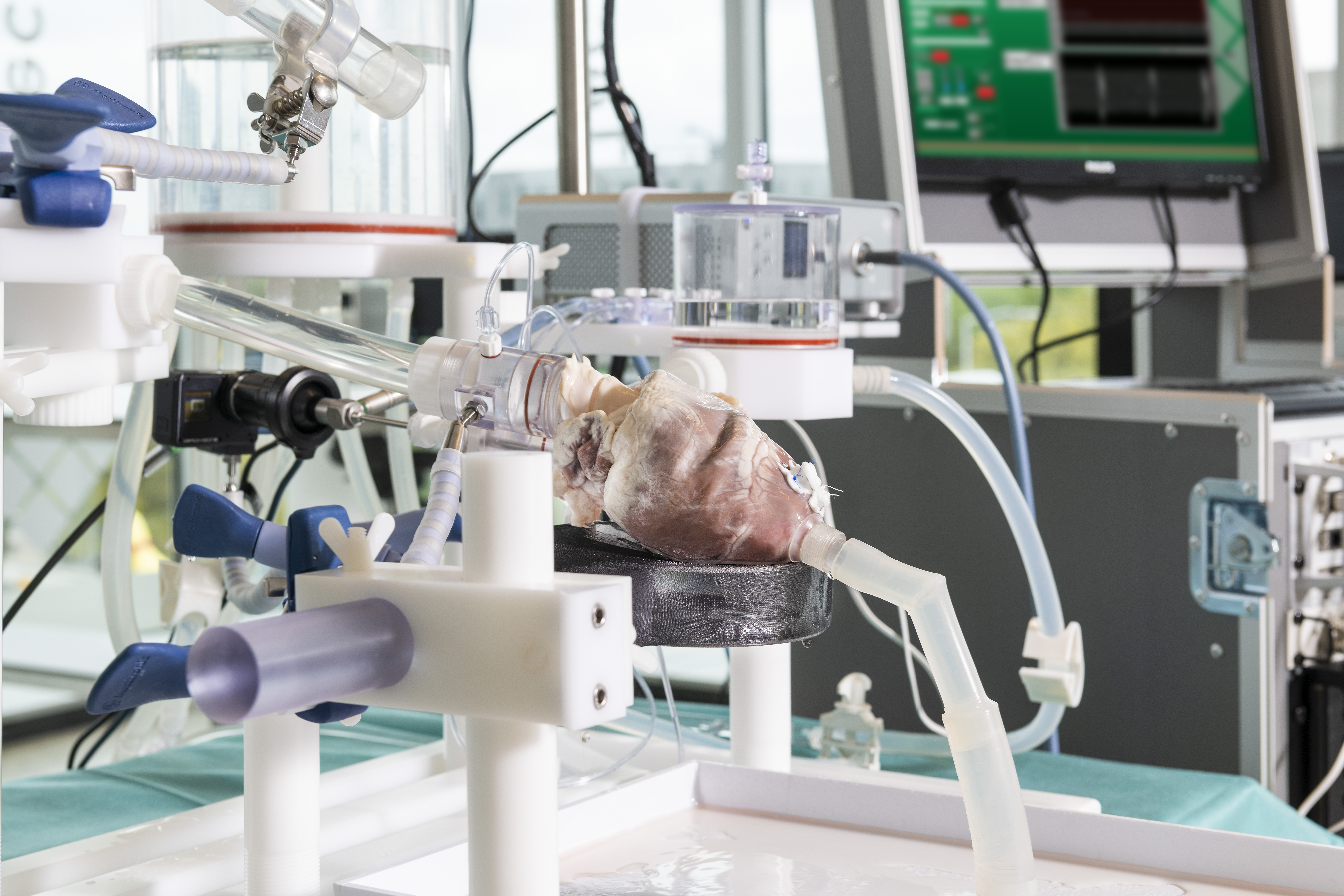 CBS and 3D MTE | LifeTec Group