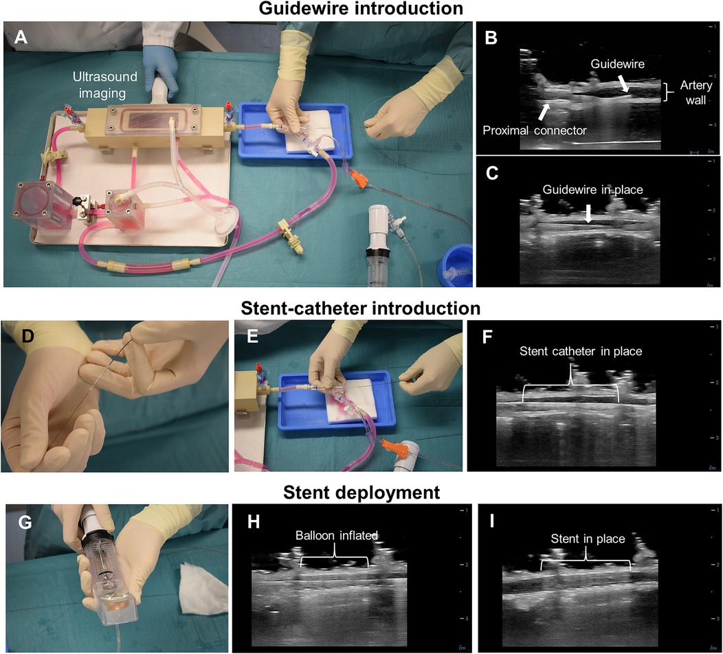 Rethinking Coronary Stent Testing: A Practical Step Toward Ethical ...