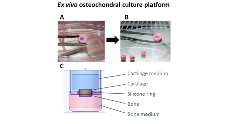 CARTILAGE REGENERATION | LifeTec Group